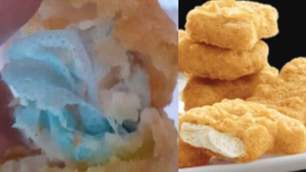 Duh! Gadis Kecil Tersedak Sobekan Masker Biru Dalam Chicken Nugget ...